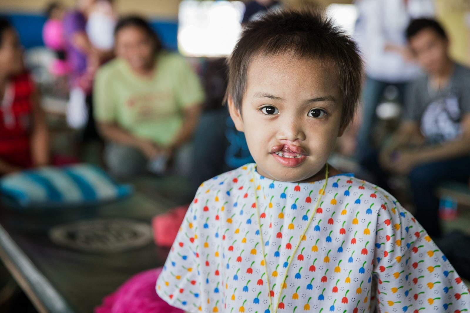 ABOUT CLEFT LIP & CLEFT PALATE